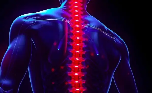 Bone Cancer in Spine Life Expectancy: Prognosis, Treatment Options ...