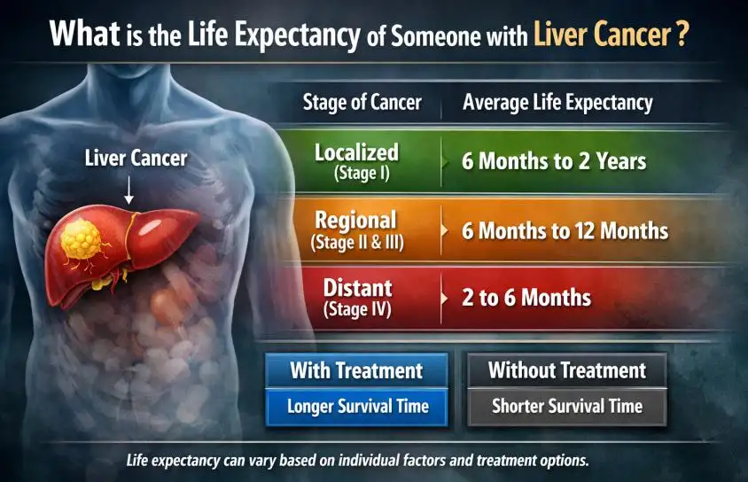 What is the Life Expectancy of Someone with Liver Cancer ...